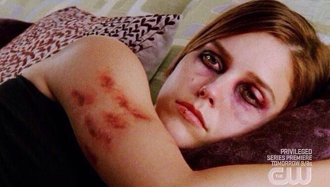 Brooke After Being Attacked By Xavier One Tree Hill One Tree Paw Print