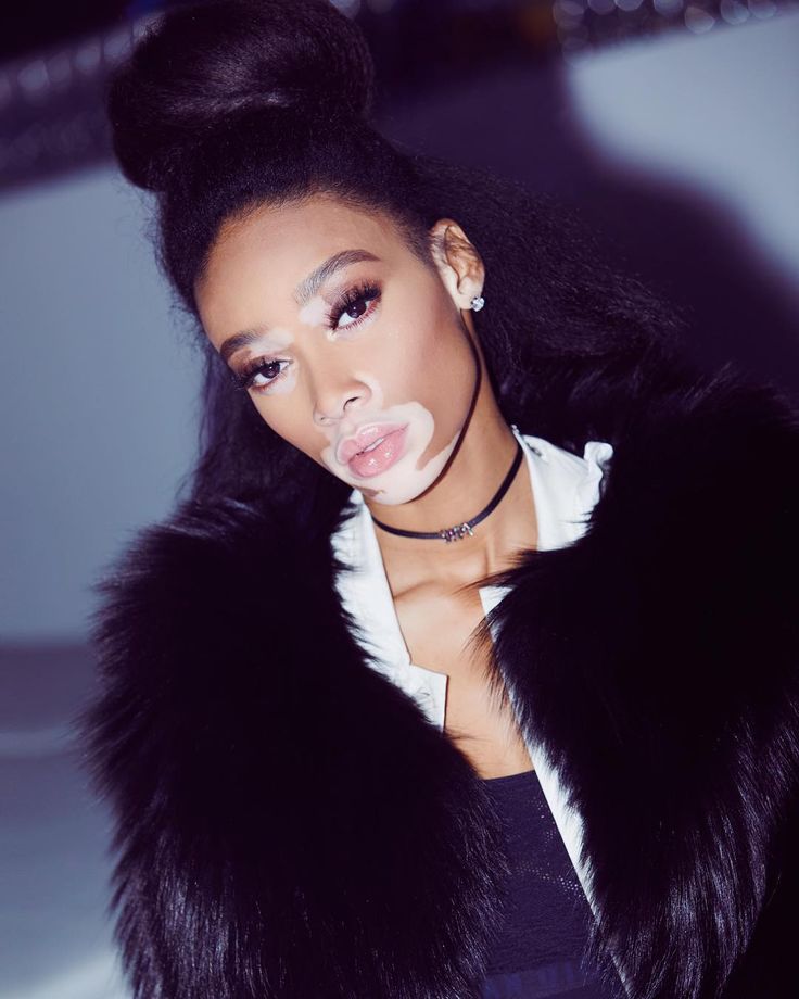 655 Mil Me Gusta 264 Comentarios ♔winnie Harlow♔ Winnieharlow En Instagram