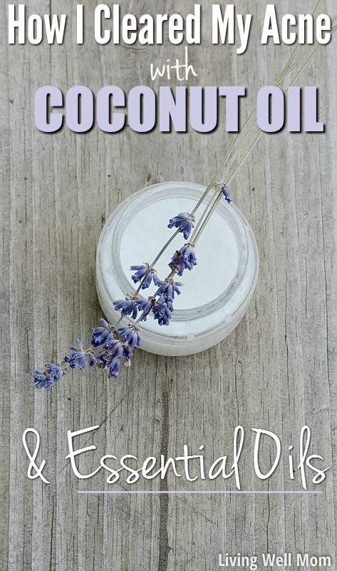 How I Cleared My Acne With Coconut Oil And Essential Oils Living Well
