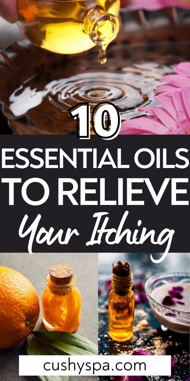 10 Essential Oils For Itching According To Science And More Essential