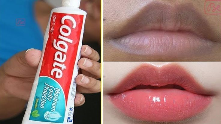 Avoir Des Lèvres Roses De Façon Naturelle Astuce Facile De Pâte