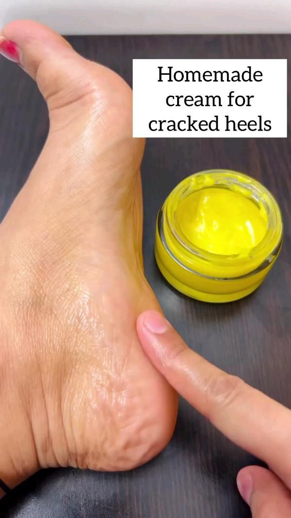 Homemade Cracked Heels Cream 💫 Foots Care Tips ️ Homemade Remedy 😍