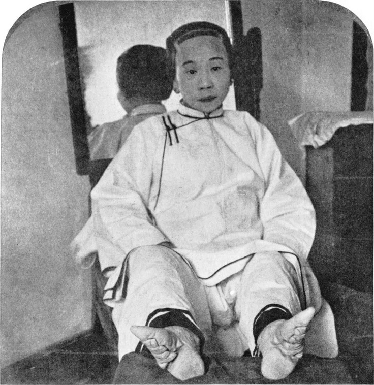 Pussymold Chinese Foot Binding The Lily Feet Originating In The Sung
