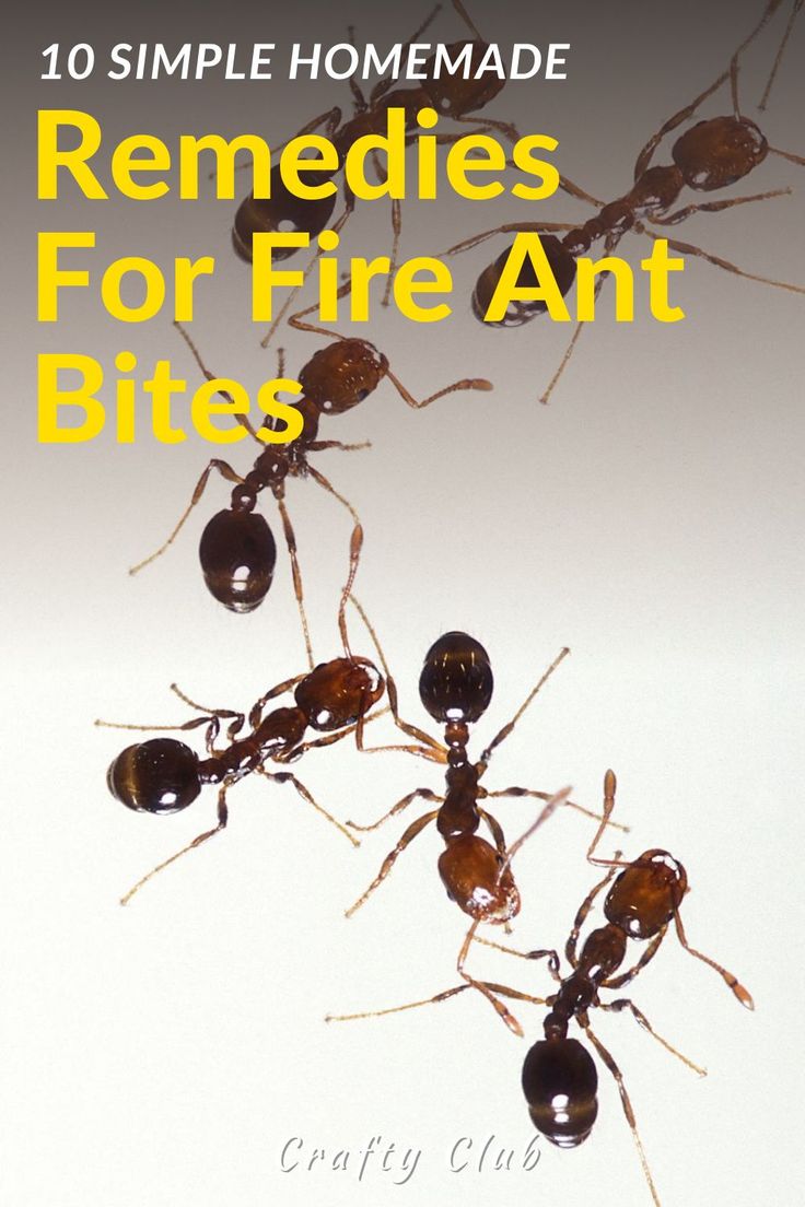 10 Simple Homemade Remedies For Fire Ant Bites Fire Ant Bites Ant Bites Fire Ants