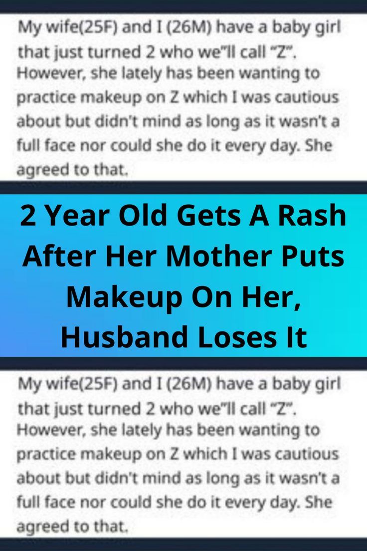 2 Year Old Gets A Rash After Her Mother Puts Makeup On Her Husband
