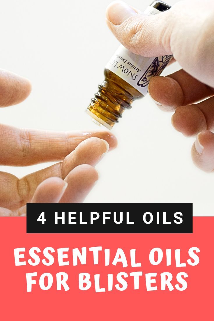 Essential Oils For Blisters Treat Blisters Naturally On Your Skin And