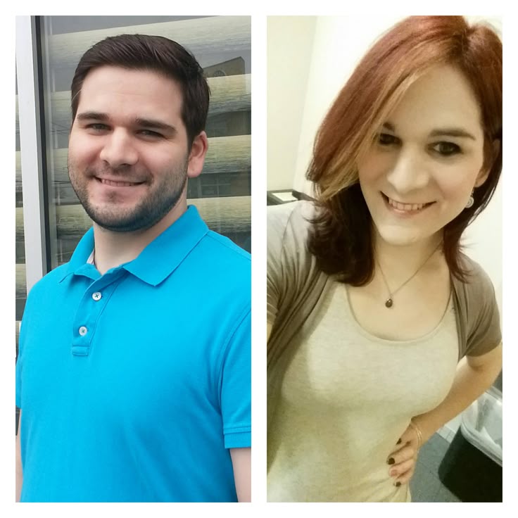 Rachel Reese 25 Months On Hrt Before And After Male To Female Transformation Male To Female