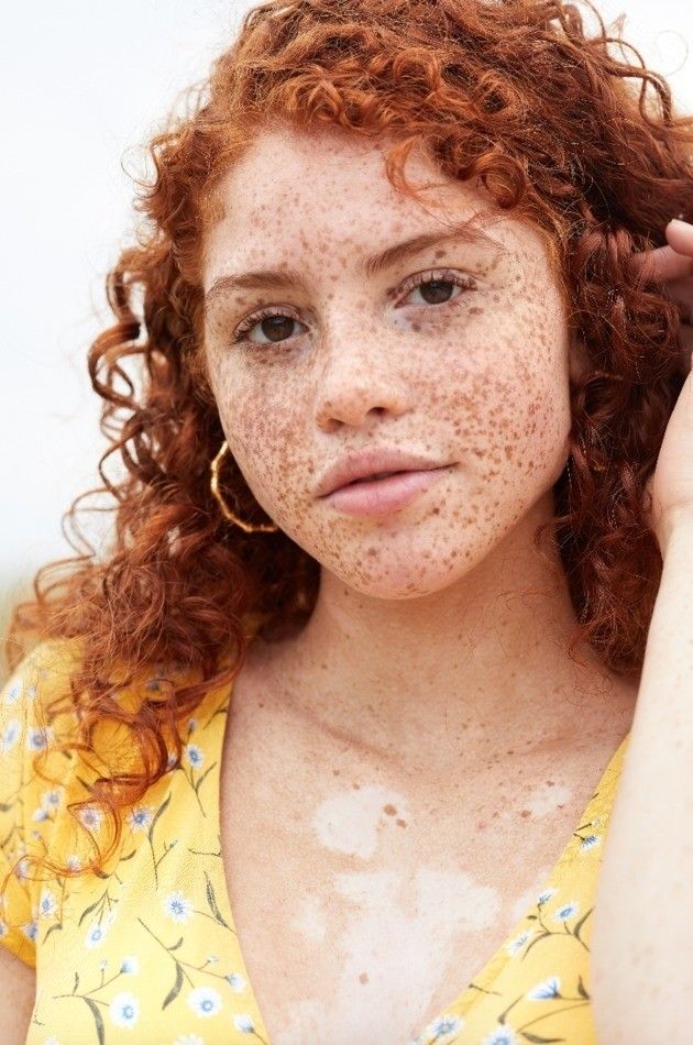 Pin By Nancy Rocio On Beauté Beautiful Freckles Beautiful Curly Hair Face Hair