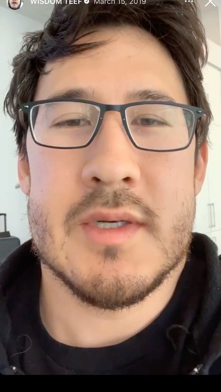 Chubby Cheek Mark Chubby Cheeks Chubby Cheek