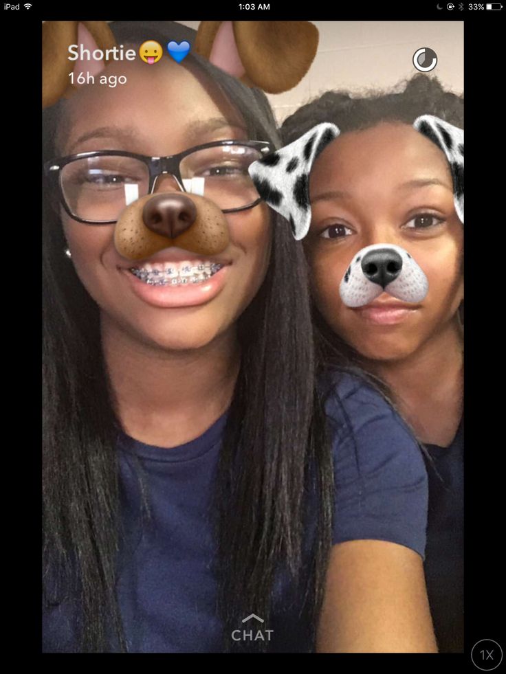 Follow Your Girl Itsyourgirlkiki For More Popin Pins Cute Girls With Braces Braces Girls