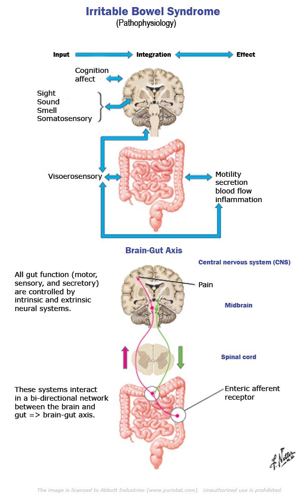 47 Best Irritable Bowel Syndrome Images On Pinterest Irritable Bowel Syndrome Gut Health And