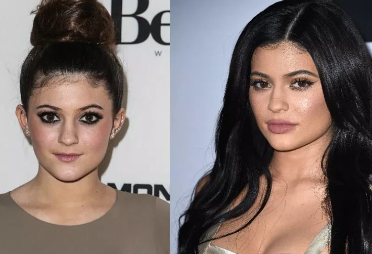 New And Improved The Top 15 Celebrity Plastic Surgeries For The Win Celebrity Surgery