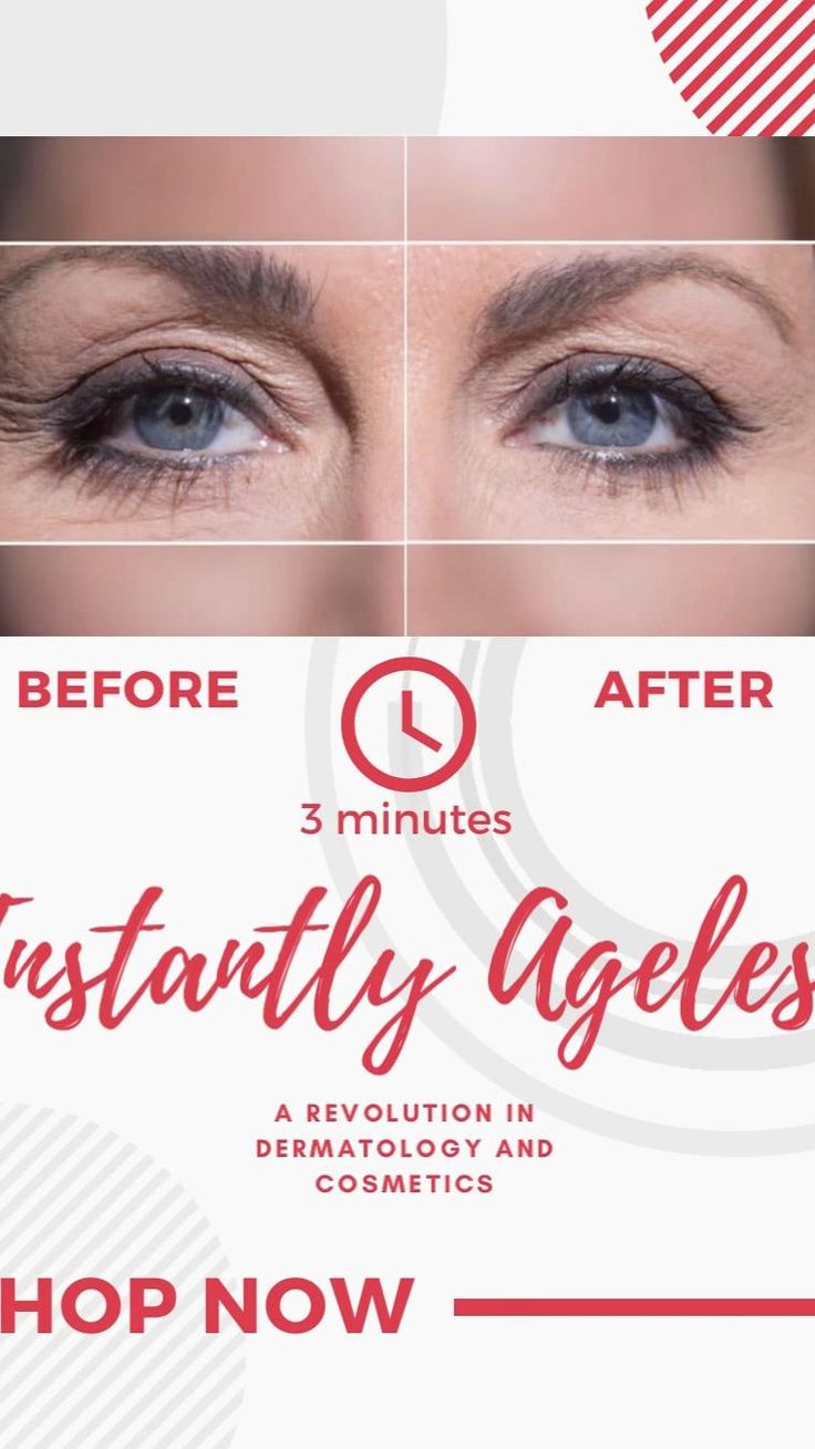 Pin On Instantly Ageless