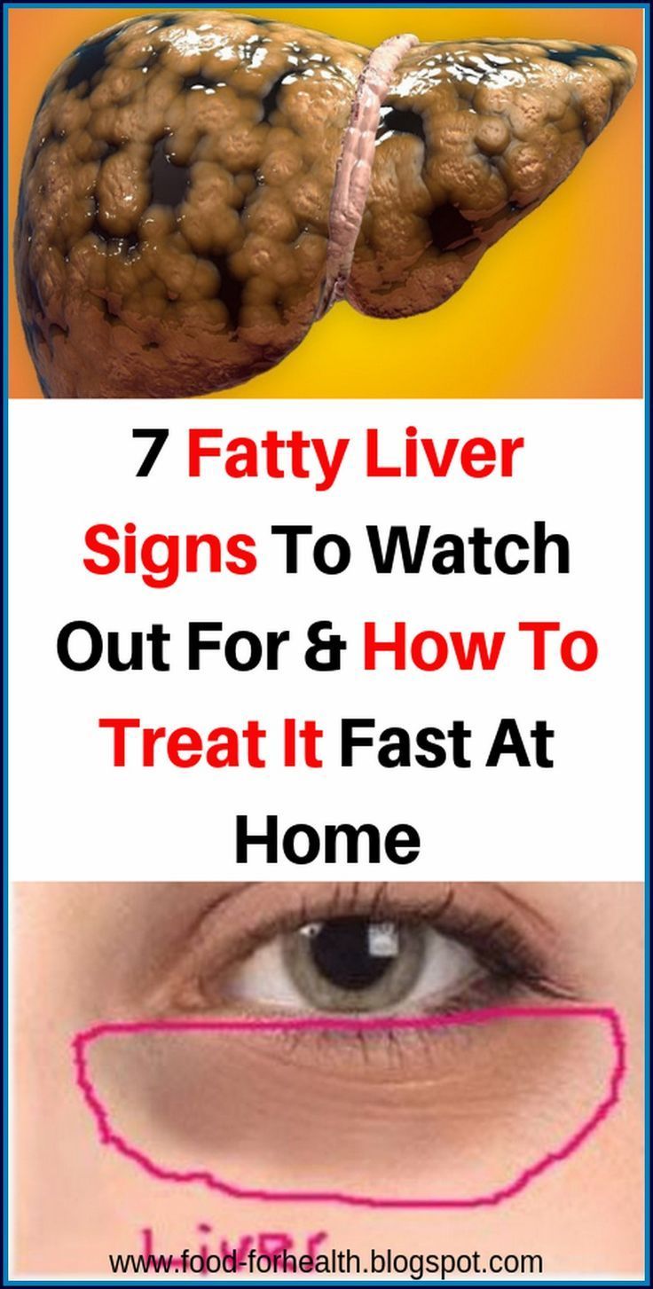 Pin On Diet And Exercise