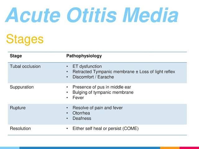 Stages Of Otitis Media