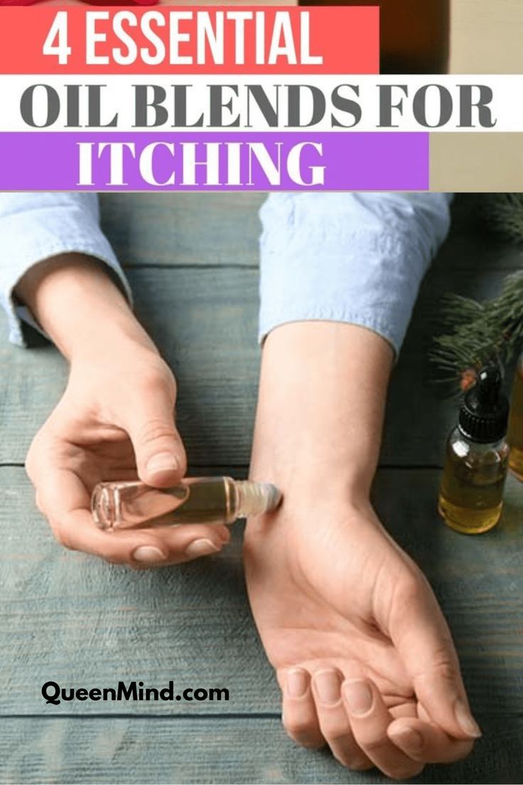 Essential Oils That Instantly Relieve Itchy Skin Queenmind