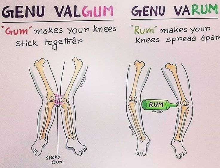 Pin By Selena G On Pt Genu Valgum Genu Varum Future Doctor