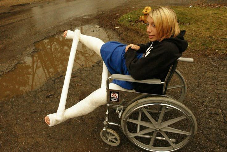 Pin By Ciara Casts On Quad Body Cast Leg Cast It Cast
