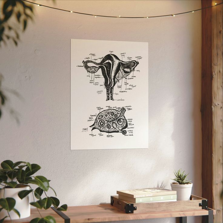 Uterus Anatomy Print Diagram Female Reproductive Labor Delivery Nurse Uterus Art Obgyn T For