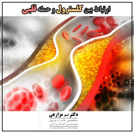 🔵ارتباط بین کلسترول و حمله قلبی کلسترول بالا، اصلی ترین فاکتور خطر