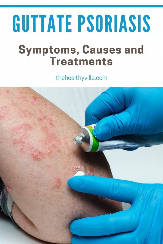 Guttate Psoriasis Symptoms Causes And Treatments Guttate Psoriasis