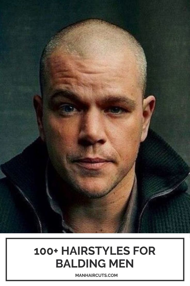 100 Hairstyles For Balding Men Pictures Included Balding Mens Hairstyles Haircuts For