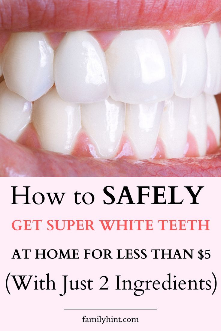 How To Get Whiter Teeth Teeth Whitening Remedies That Work Cure