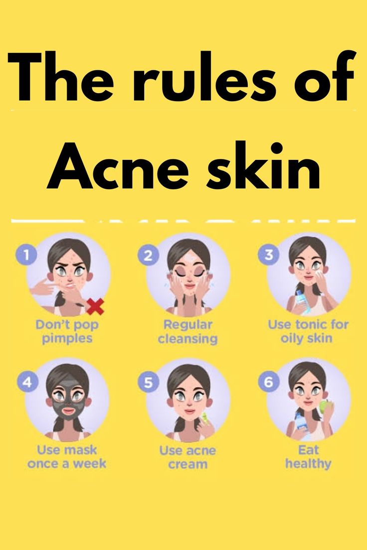 Acne Skin To Beauty Skin Acne Skin Care Routine Skin Care Tips
