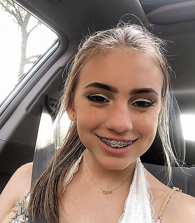 Pin By Dani Groestien On Cute Girls With Braces Cute Girls With