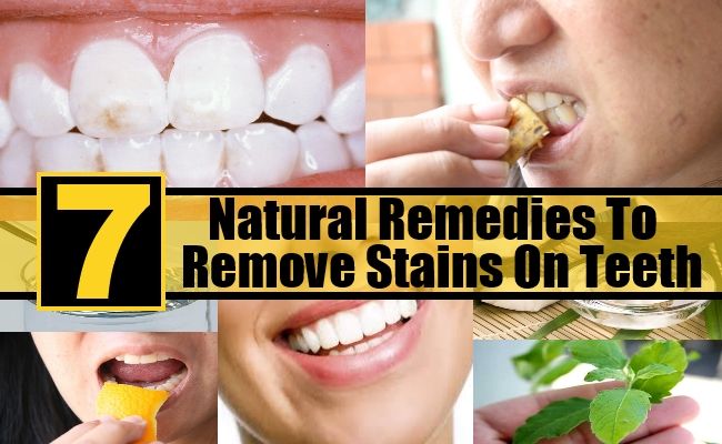 Remove The Green A Comprehensive Guide To Vanquishing Teeth Stains