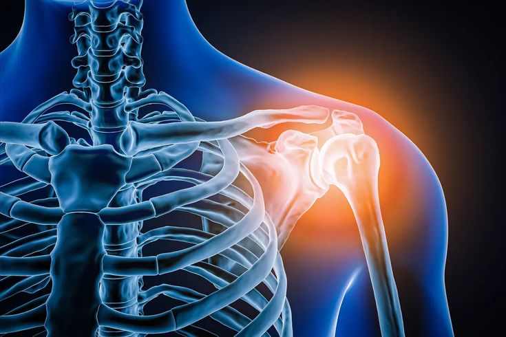 Frozen Shoulder An Inflammatory Condition And 6 Top Exercises For Relief The Epoch Times