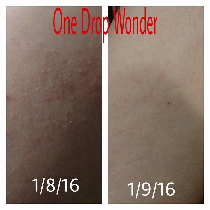 Épinglé par Nikki Campbell sur LimeLight by Alcone Skin Care RESULTS Épinglé par Nikki Campbell sur LimeLight by Alcone Skin Care RESULTS