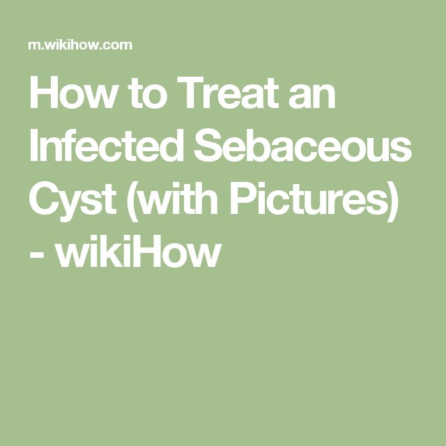 How To Treat An Infected Sebaceous Cyst With Pictures Wikihow Sebaceous Gland Epidermis