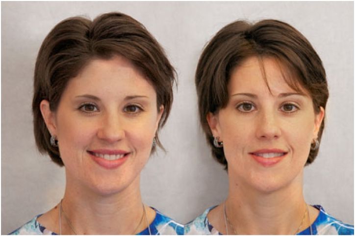 We Collected A Large Biometric Dataset From Volunteer Identical Twins