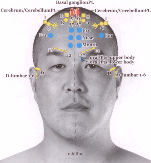 Schematic Representation Of The Frontal Ynsa Basic Points Needles Are Applied Acupuncture