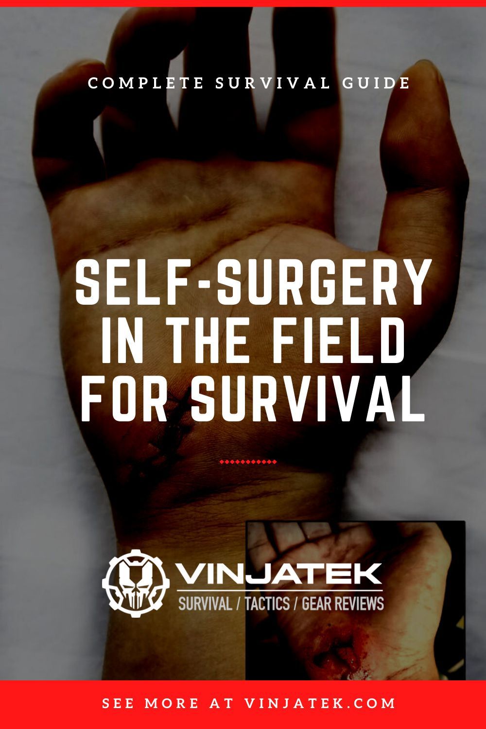 Self Surgery In The Field For Survival Vinjatek Survival Survival Life Hacks Surgery