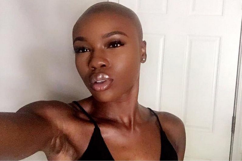 19 Stunning Black Women Whose Bald Heads Will Leave You Speechless Black Women Hair Loss Bald