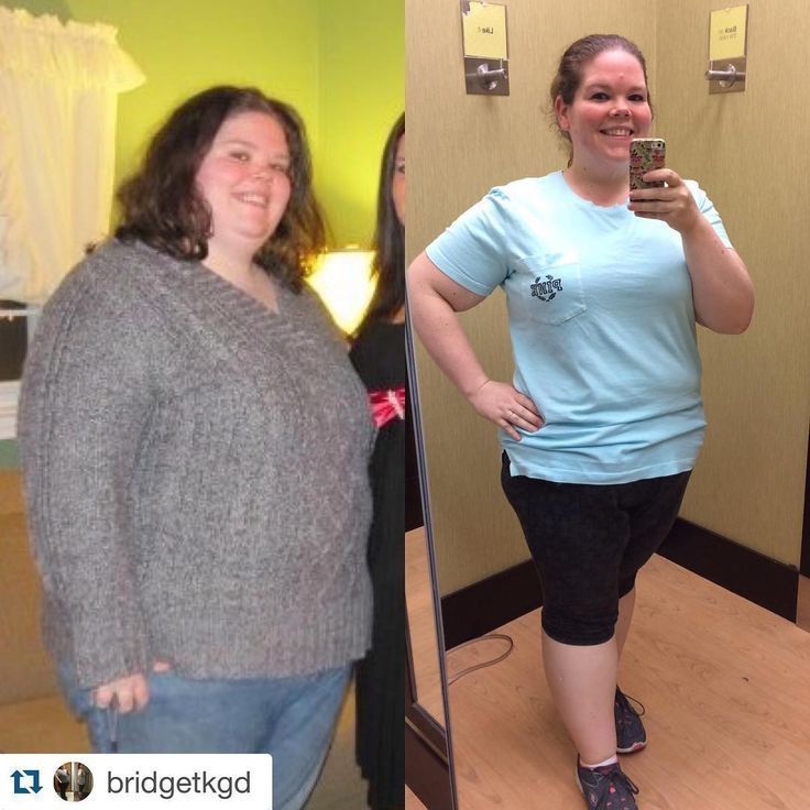 Pin On Before And After Weight Loss Transformation Stories
