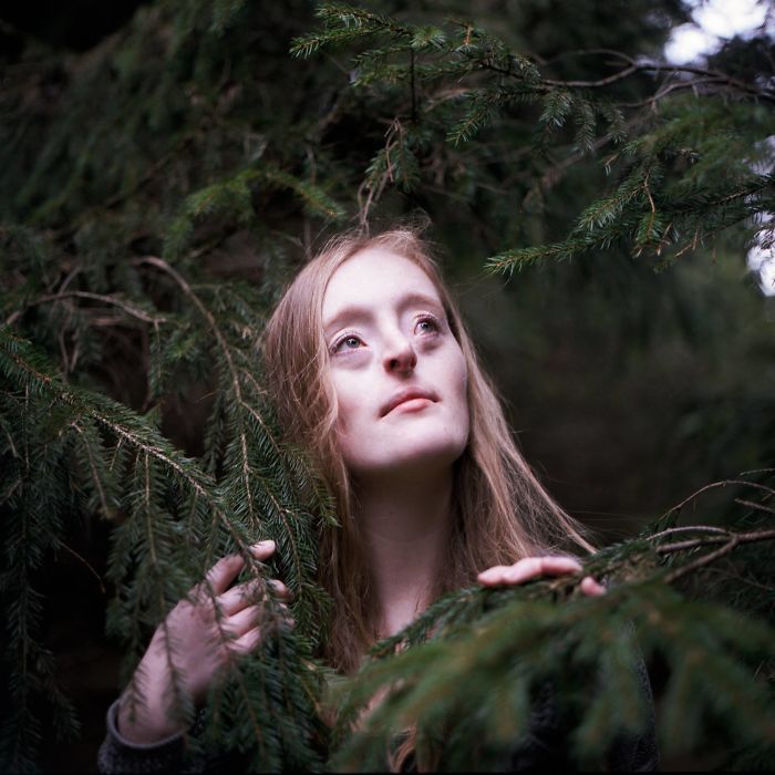 26 Year Old Born With Extremely Rare Facial Defect Is Breaking Beauty