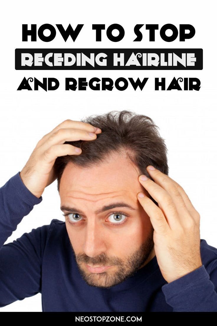 Treat Your Hair Loss Now Men Edition Artofit