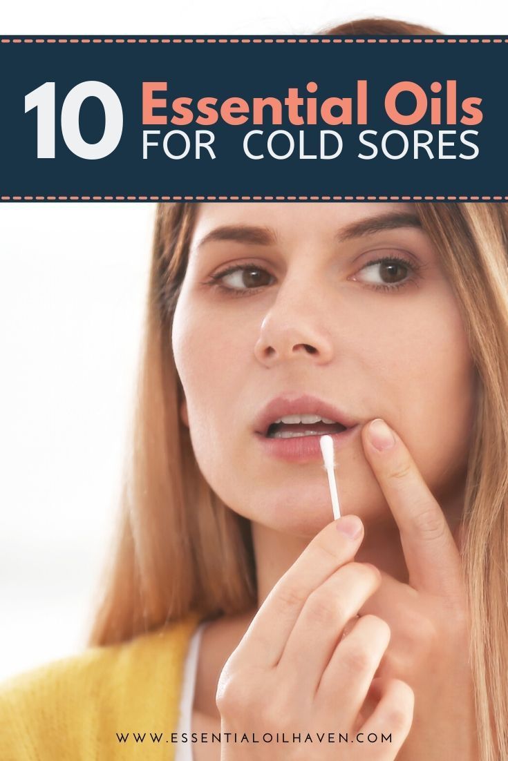 Top 10 Essential Oils For Cold Sores Get Rid Of A Cold Sore Fast
