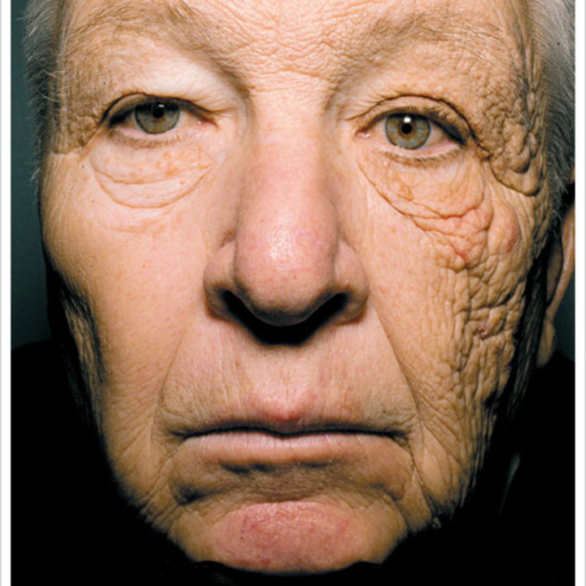 This Story Is A Compelling Case To Use Sunscreenhuffto14yc28n Environ Sunscreen