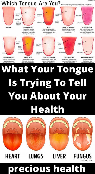 What Your Tongue Is Trying To Tell You About Your Health Artofit