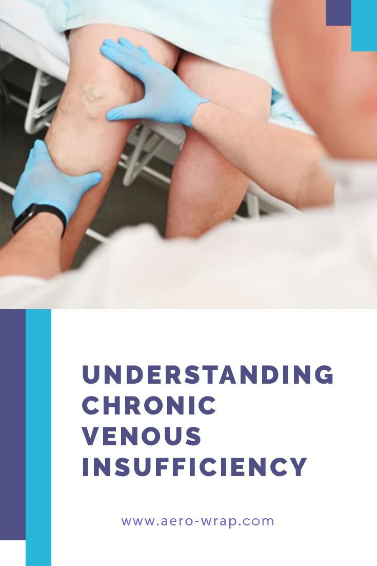 Venous Insufficiency Treatment Artofit
