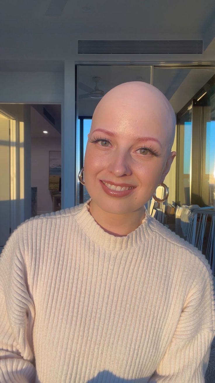 Wigs For Alopecia Artofit