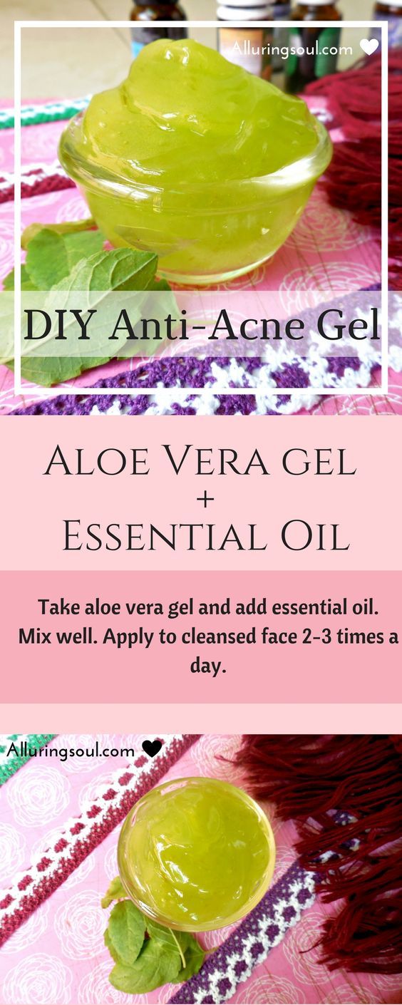 Your Own Diy Acne Gel That Works Recipe Acne Gel Tea Tree Oil For