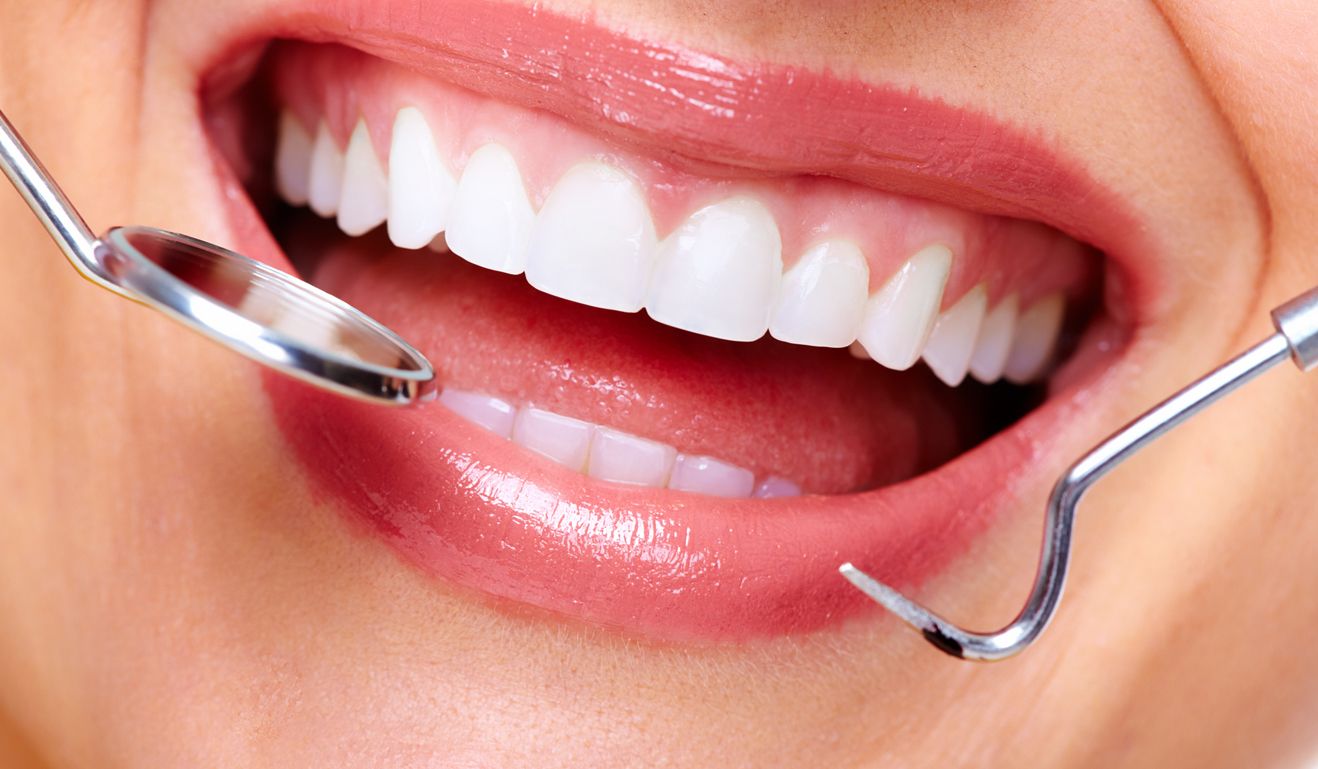 Dental Abscess Symptoms Types Causes Treatment Artofit