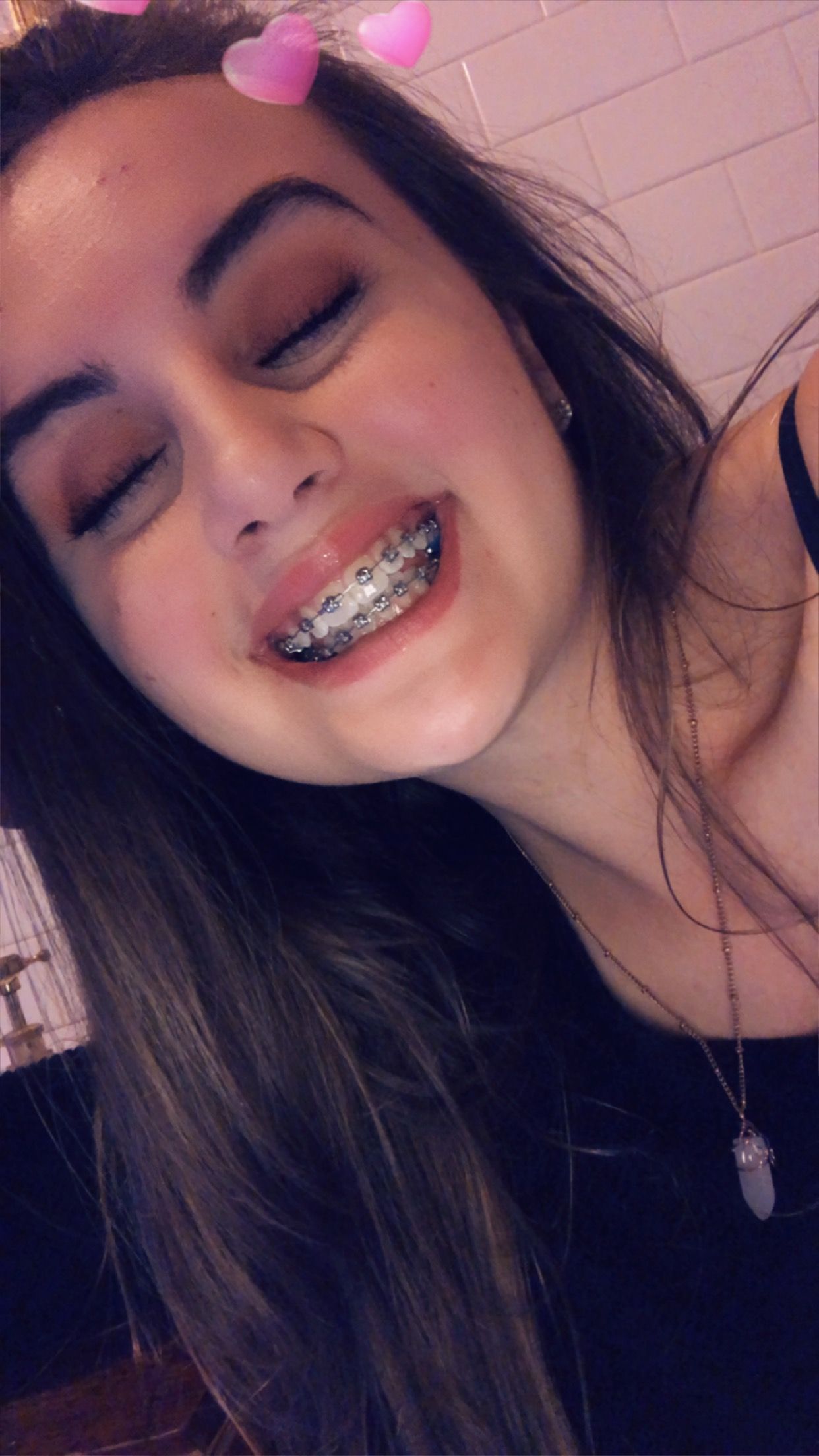 β Cutest Braces Colors