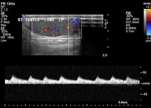 Pin On Abd 300 Mod 4 Ultrasound
