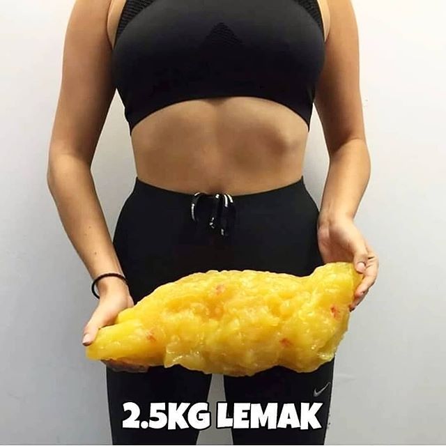 Yakin Turun 1 Kg Itu Sedikit Woww Ini Loh Penampakan 2 5kg Lemak